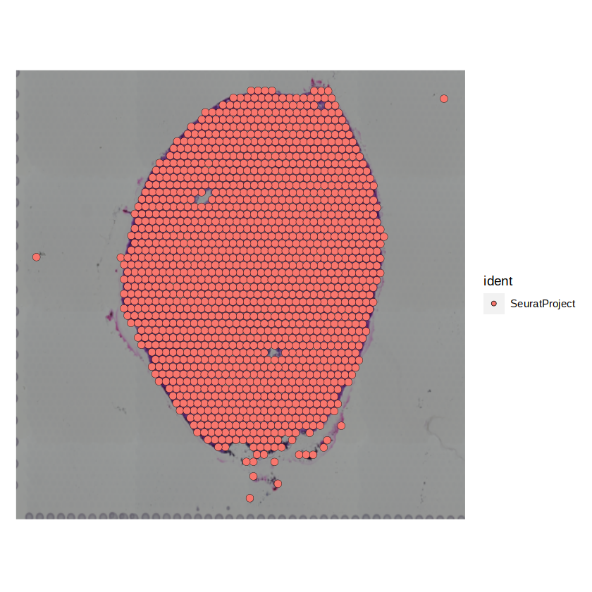 Spatial charting of single-cell transcriptomes in tissues - celltrek Spatial charting of single-cell transcriptomes in tissues - celltrek